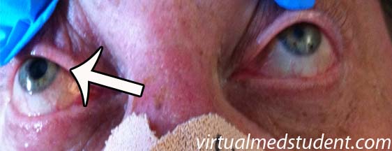 VirtualMedStudent Acute Traumatic Brain Injury VirtualMedStudent Acute Traumatic Brain Injury